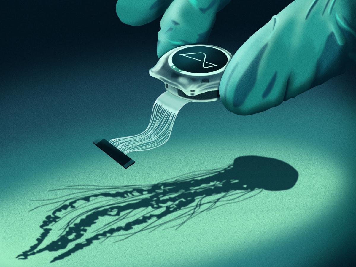 Elon Musk's new brain chip: A major tech-science milestone | Al Majalla