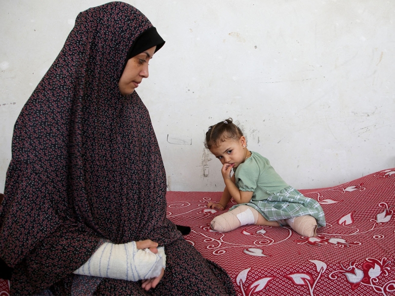 Missing limbs and broken dreams: Gaza's generation of child amputees ...